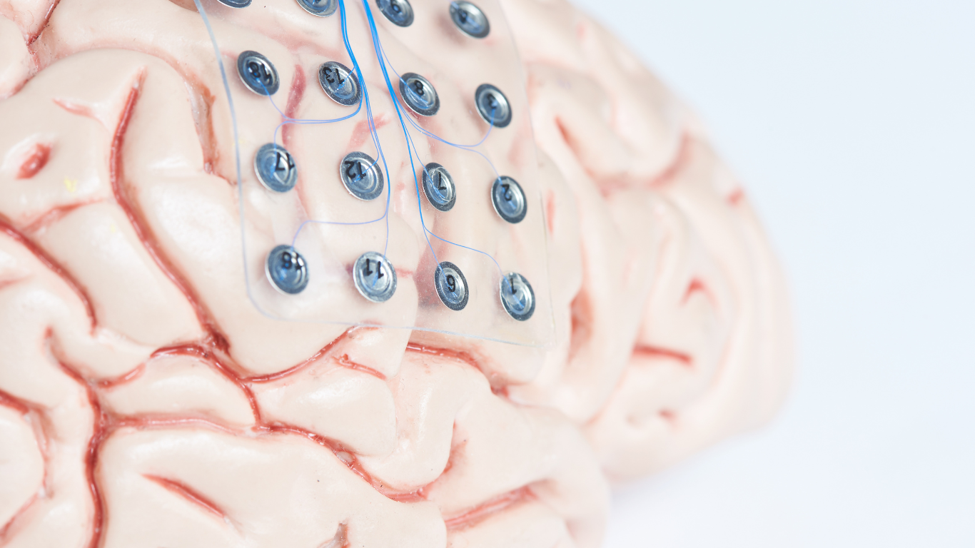 Neurofeedback Therapy Our Vision Masterpiece Braincore And Consulting
